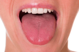 Dry and rough tongue: causes and treatment - Fastlyheal