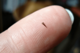 Buttock abscess: causes, treatment and home remedies - Fastlyheal