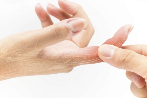 Why do i have red knuckles - Fastlyheal